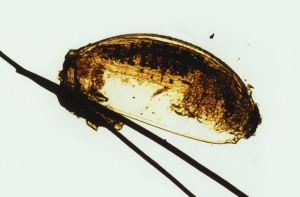 Läuse und Haarlinge | ESCCAP DEUTSCHLAND